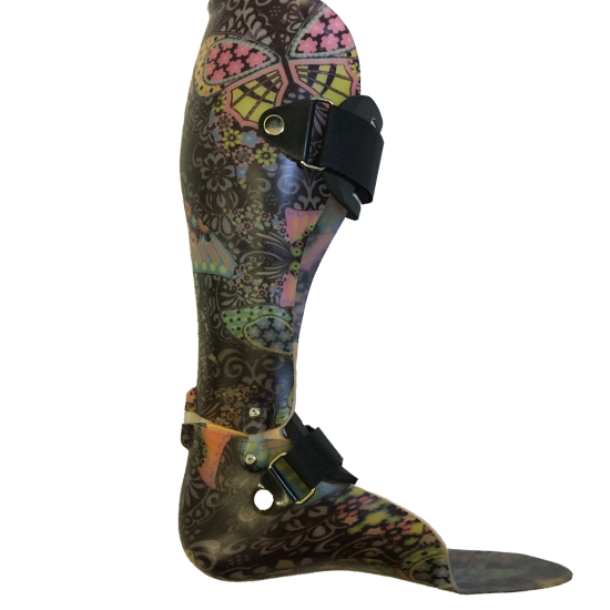 Custom Made Orthoses - Inmotion Orthotics