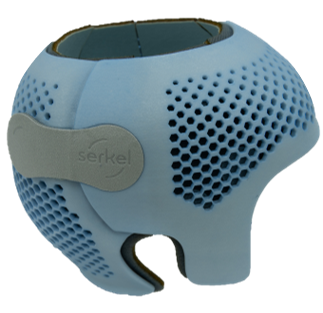 Plagiochephaly - InMotion Orthotics